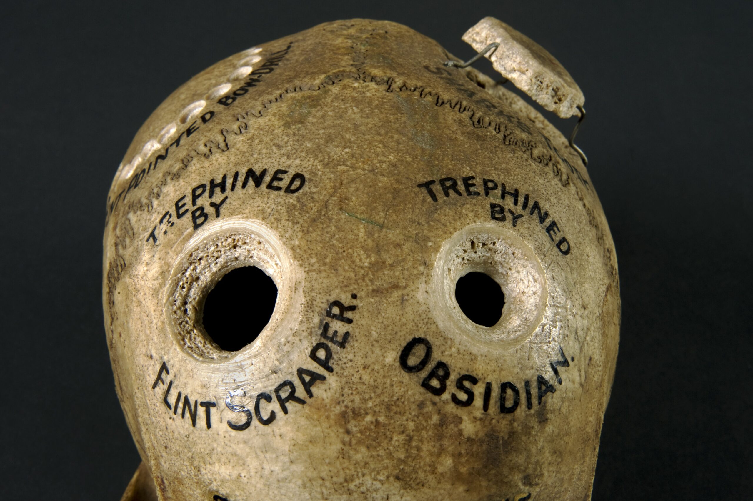 Trepanation: A Brief History of Drilling Holes in the Head | Chemical ...